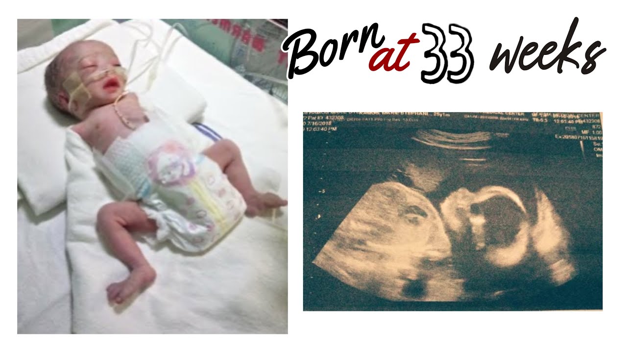 My preterm baby girl born at 33 weeks via Normal delivery | A touching ...