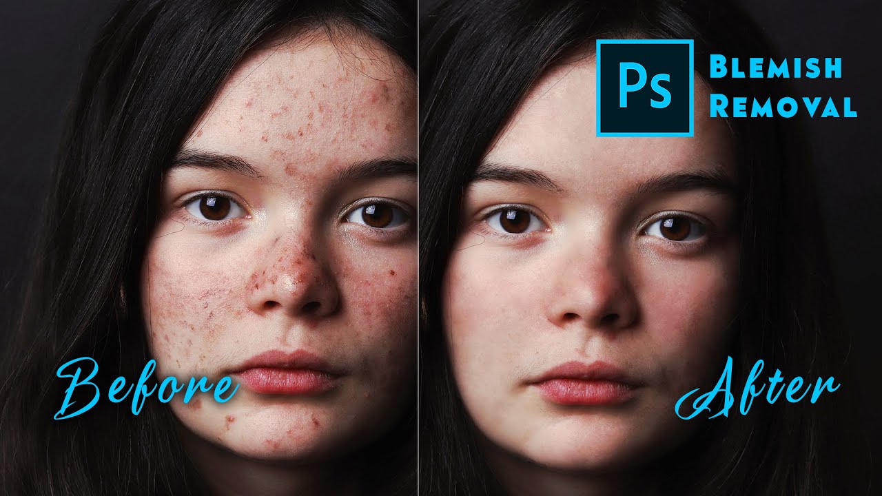 How To Remove Acne In Photoshop 2020 YouTube how-to-remove-acne-in-photoshop-2020-youtube