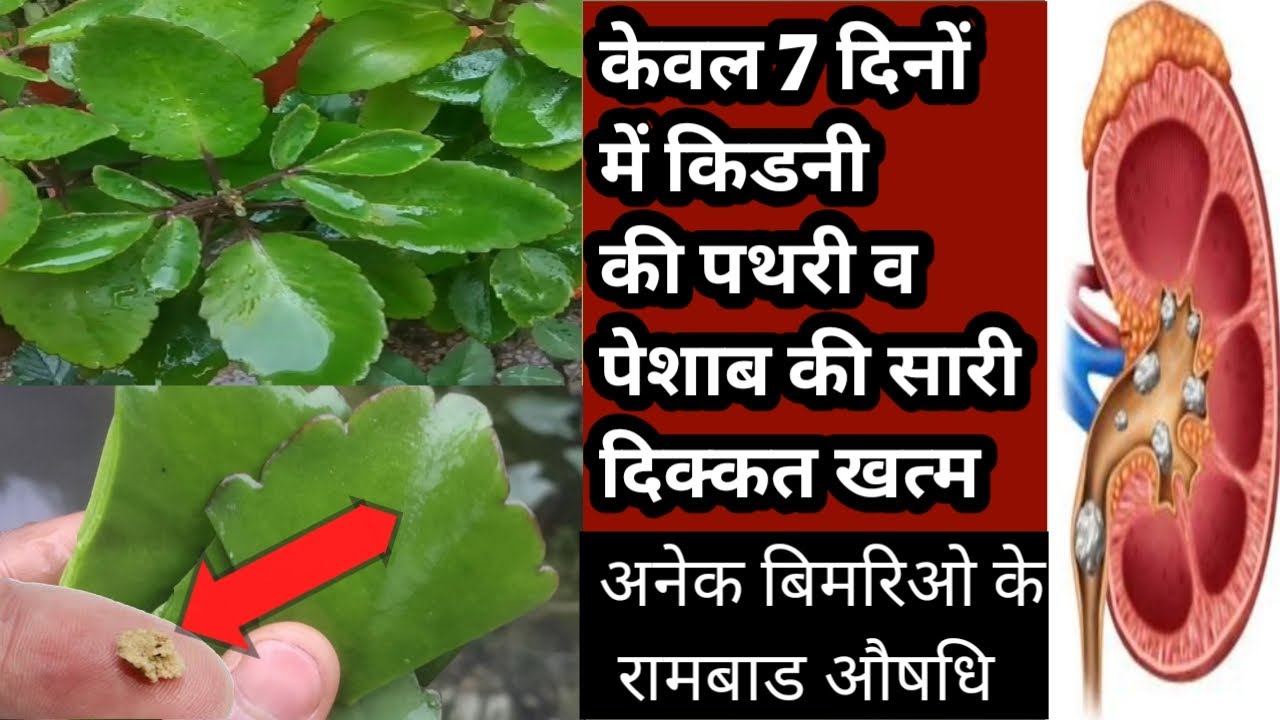 pathar chatta ka paudha | पथरी को कैसे ठीक करें kidney stone ko thik ...