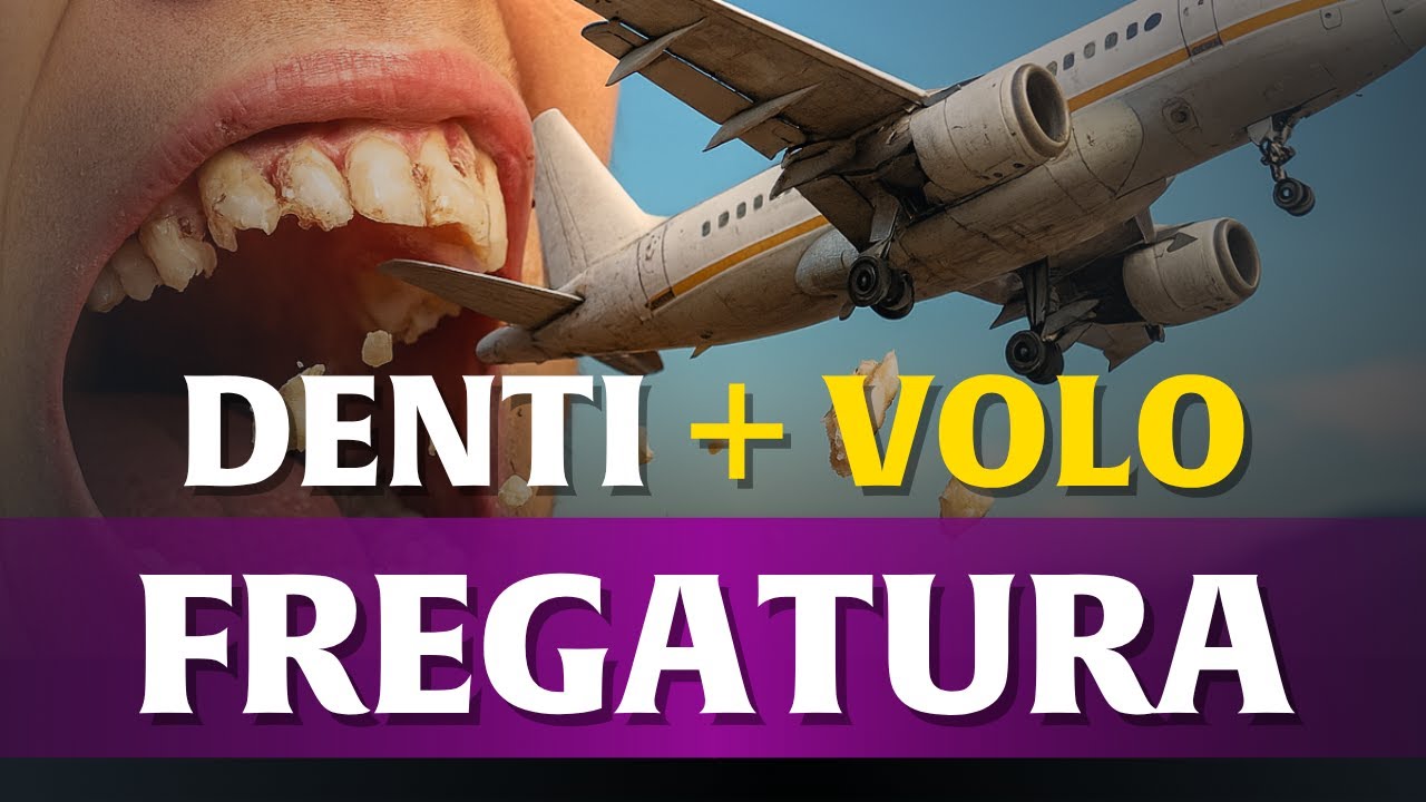 Offerta per denti fissi volo incluso? Bella fregatura - YouTube