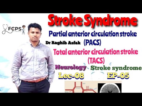 Stroke syndrome ( TACS & PACS) by Dr Raghib Asfak ( Neurology Lec-08 ...