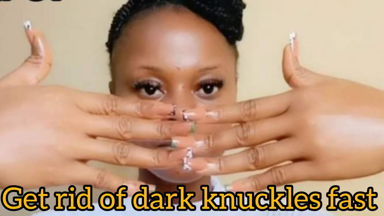 HOW TO GET RID OF DARK KNUCKLES IN FAST | DARK KNUCKLES - YouTube