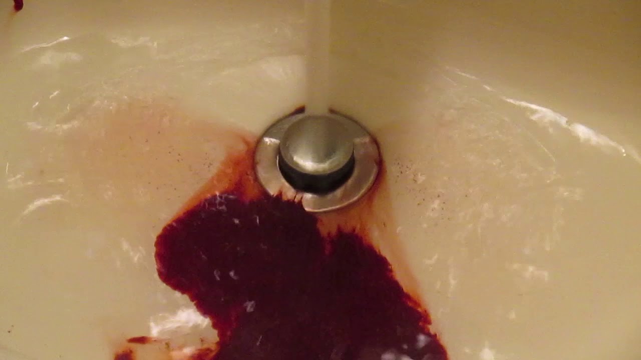 blood sink - leech - YouTube