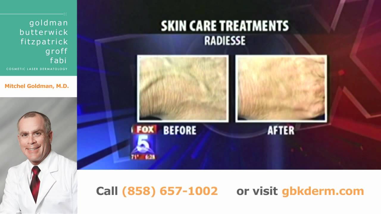 Hand Rejuvenation & Anti-Aging Tips | Mitchel P Goldman, MD - YouTube