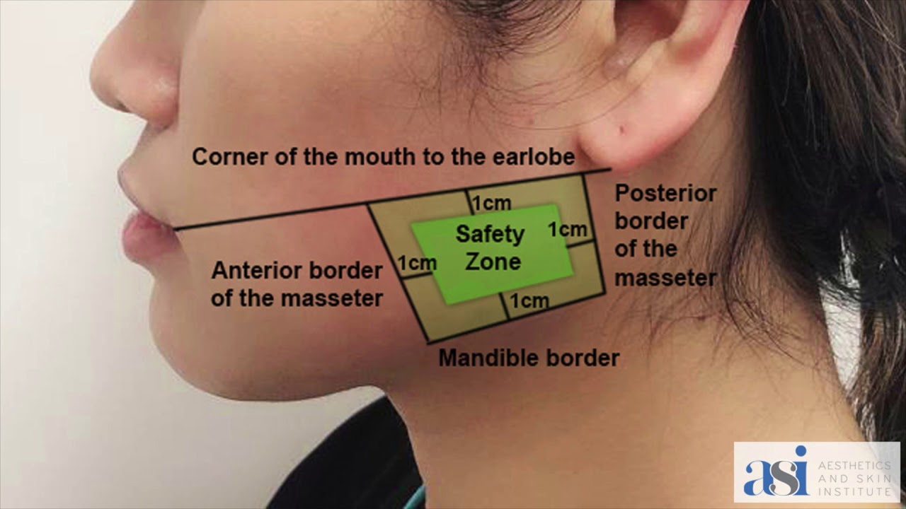 Masseter - YouTube