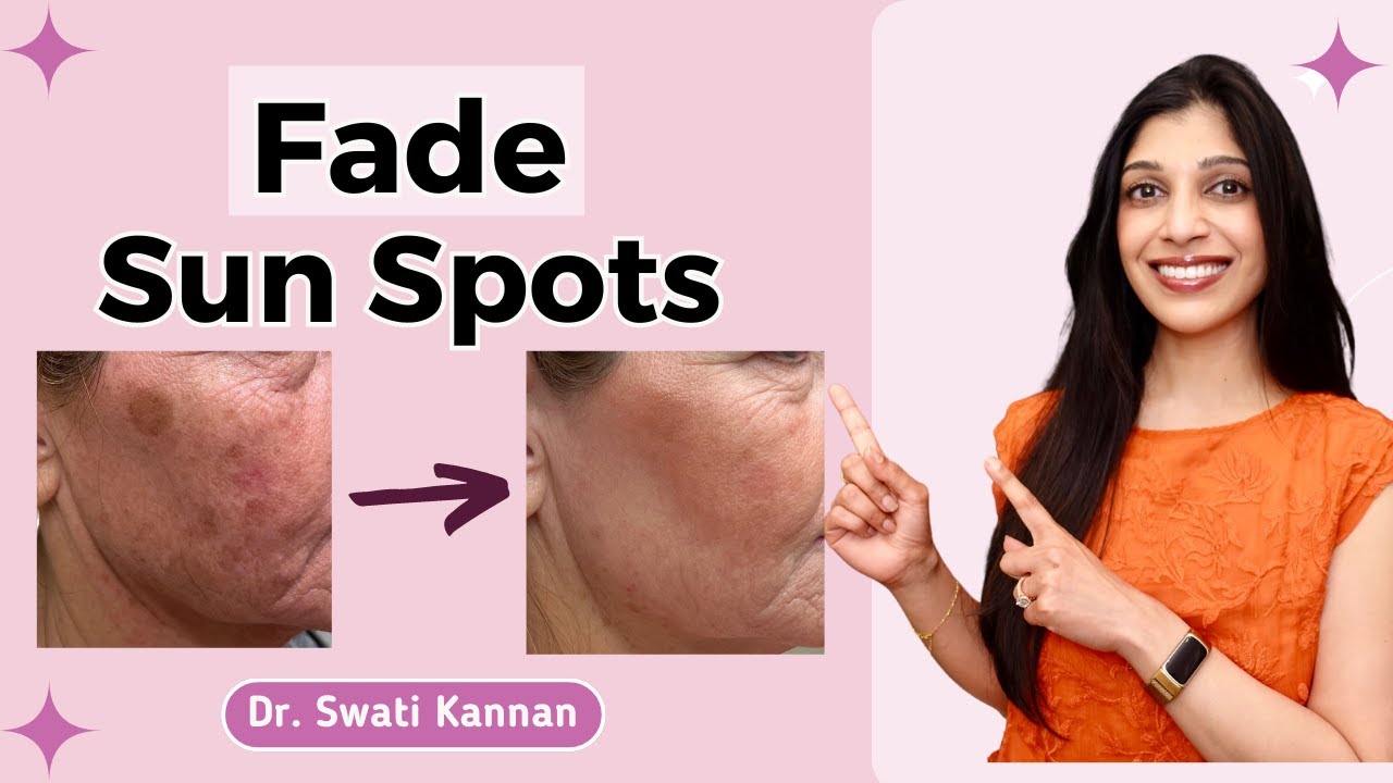 Erase Sun Spots and Sun Damage: Dermatologist's Secrets for Clear Skin ...
