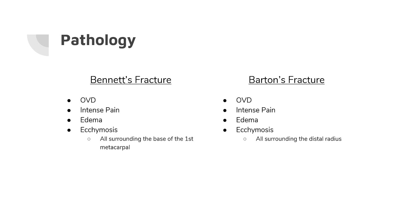 Bennett's & Barton's Fractures N Sharp - YouTube