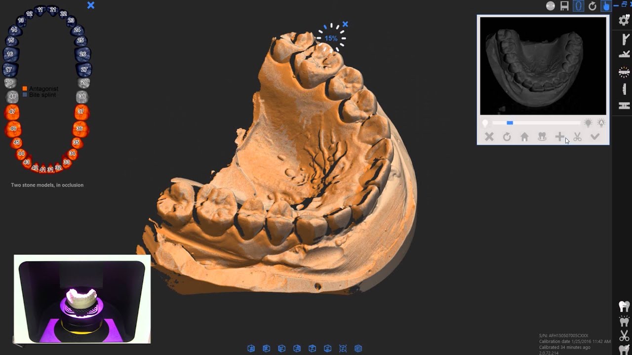 DOF Freedom HD - Dental Scanner (Orthodontic Splint) - YouTube