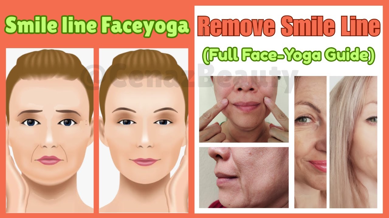 Remove Smile line in 7 day's | Get v shape face by face yoga - YouTube