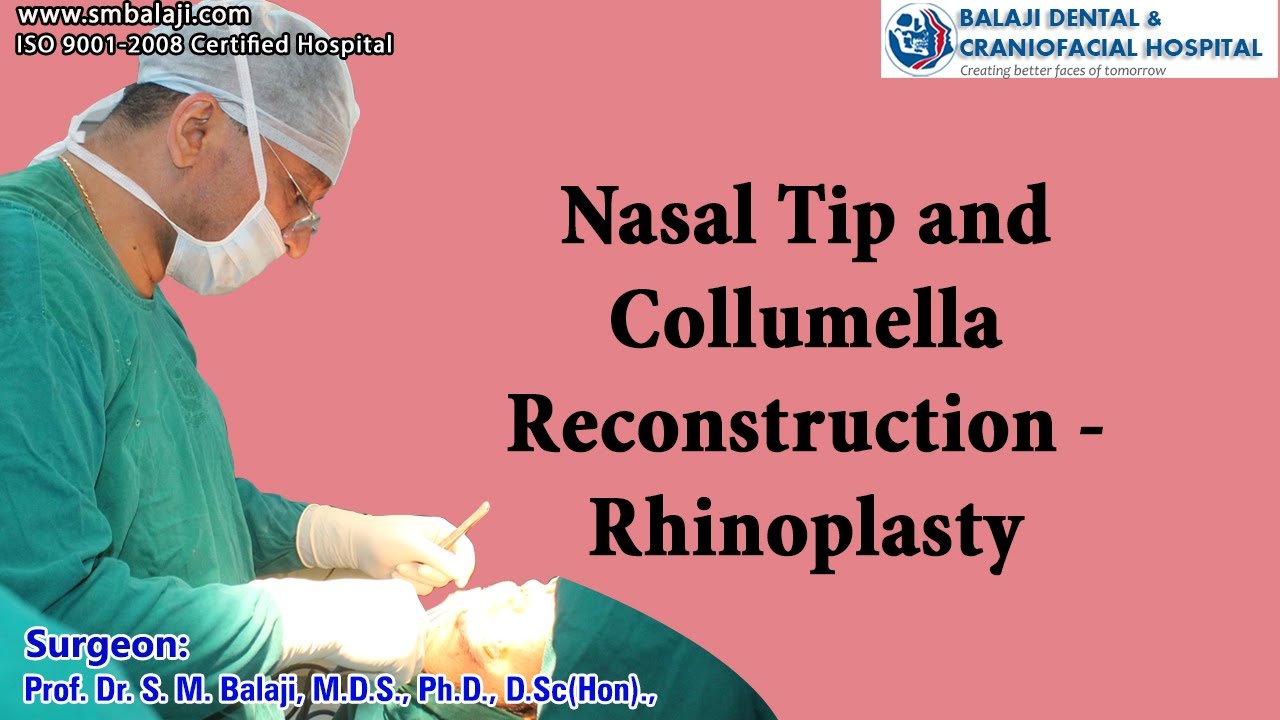 Nasal Tip and Collumella Reconstruction – Rhinoplasty - YouTube