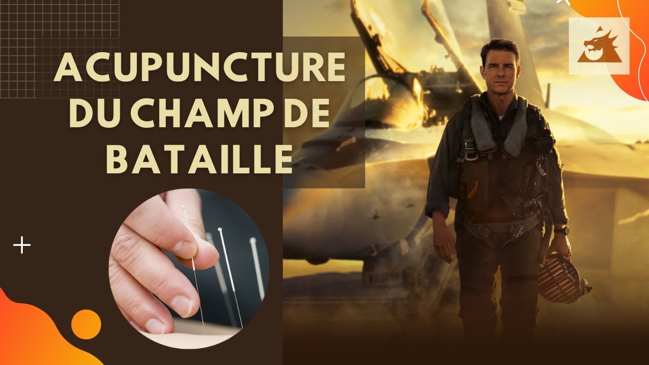 L'ACUPUNCTURE DU CHAMP DE BATAILLE ( BFA - Batttlefield Acupuncture ...