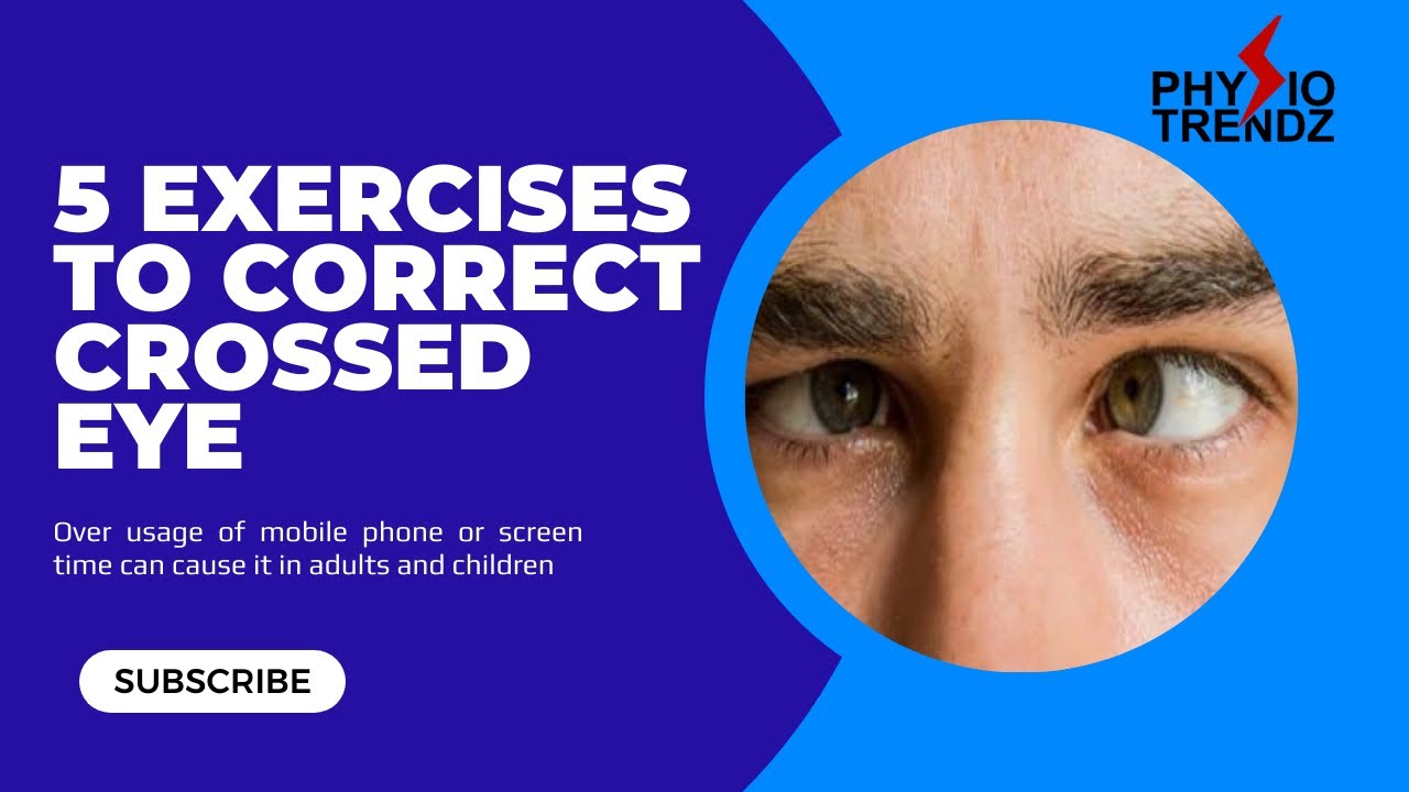 Understanding Cross Eye Syndrome: Causes, Symptoms, Physiotherapy ...