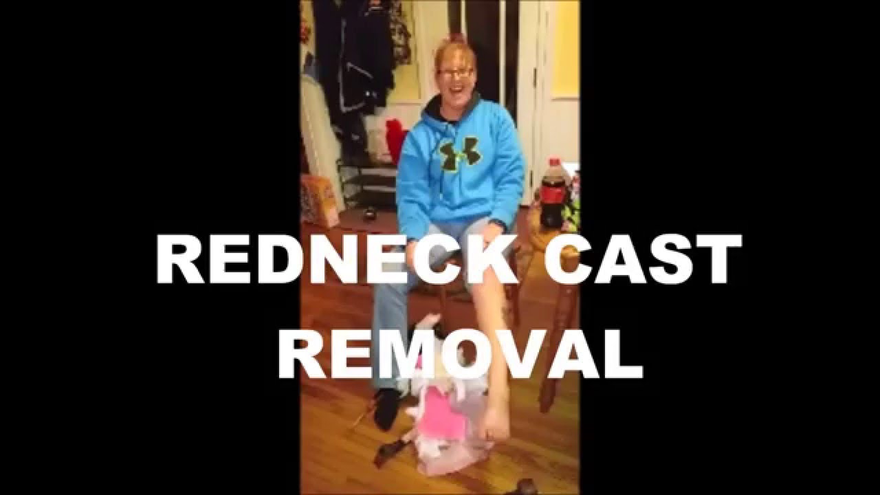 Redneck Cast Removal - YouTube