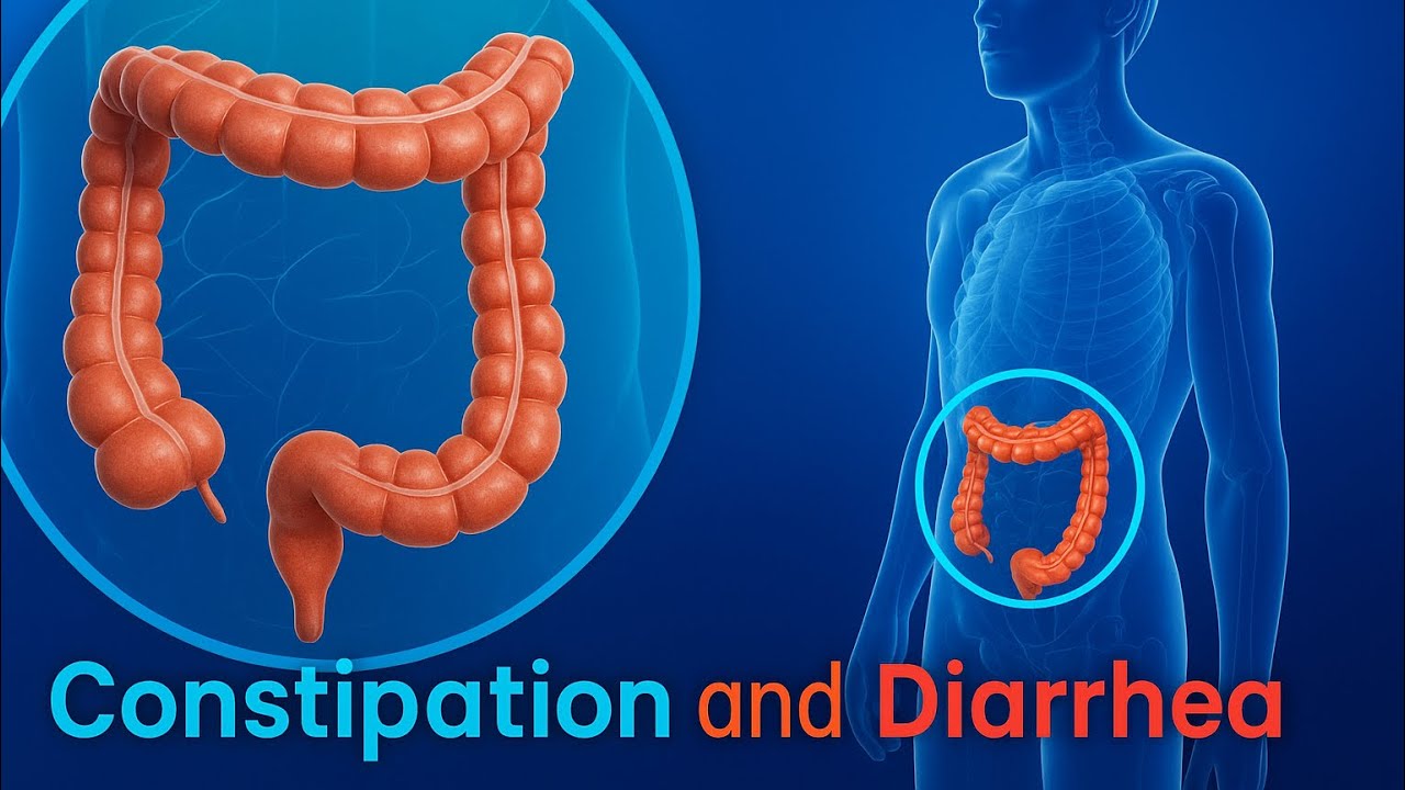 Lec 6 / Constipation and diarrhea/ part 1 - YouTube