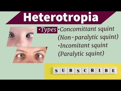 heterotropia (part-1)|| Concomitant squint||Esotropia||Exotropia|| Non ...
