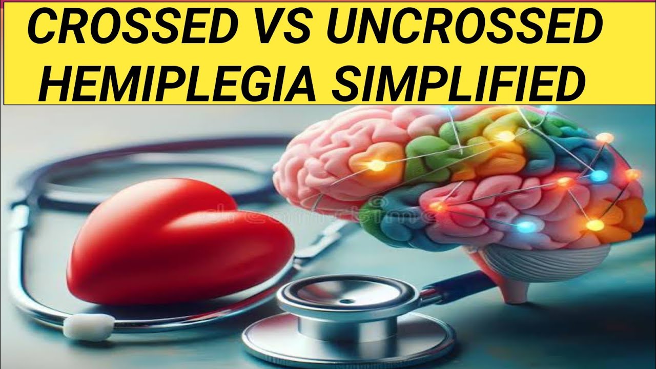 Crossed vs Uncrossed Hemiplegia|Neuroanatomy lecture 11 - YouTube
