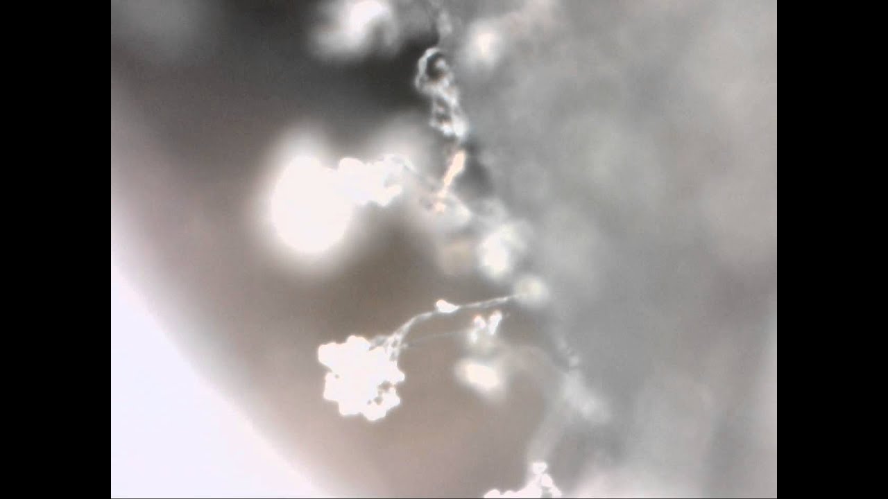 Downy Mildew of Lettuce-Bremia lactucae - YouTube