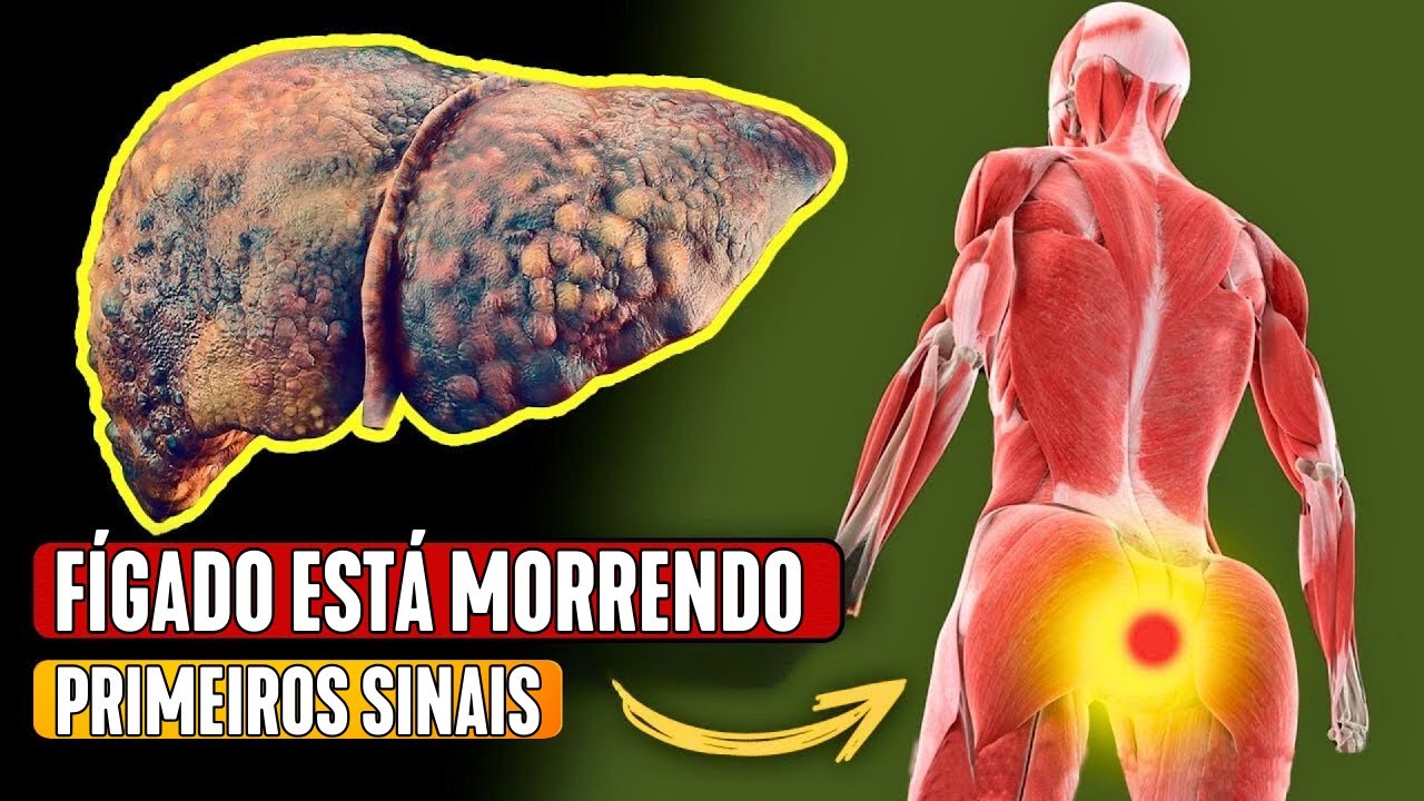 FÍGADO está MORRENDO! 12 Sinais Estranhos de DANOS HEPÁTICOS - YouTube