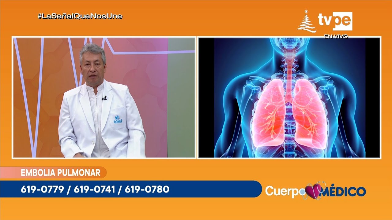Cuerpo Médico: Embolia pulmonar (27/12/2022) | TVPerú - YouTube
