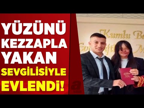 Berfin Özek, yüzüne asitli saldırıda bulunan erkek arkadaşıyla evlendi | A Haber