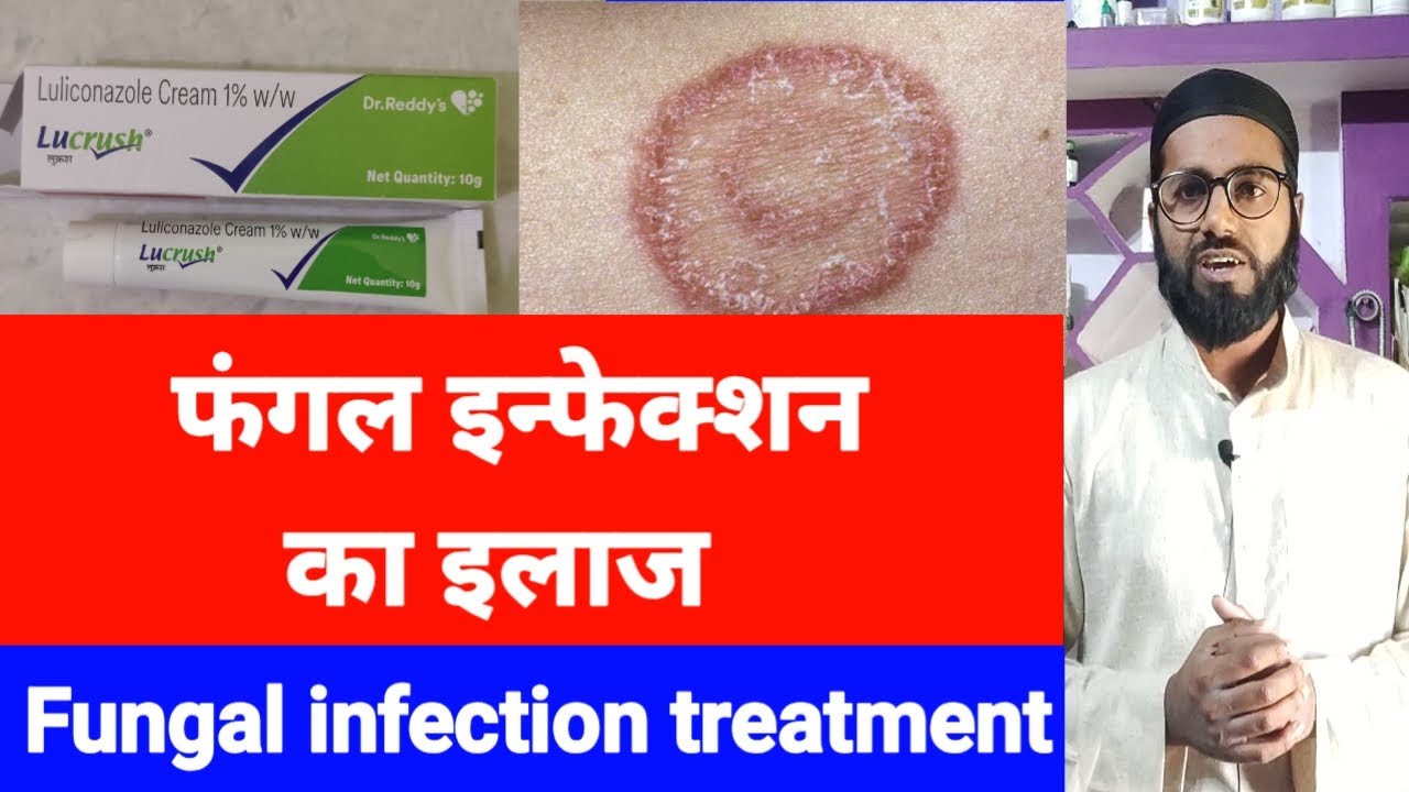 lucrush cream uses in hindi | फंगल इन्फेक्शन का इलाज | fungal infection ...