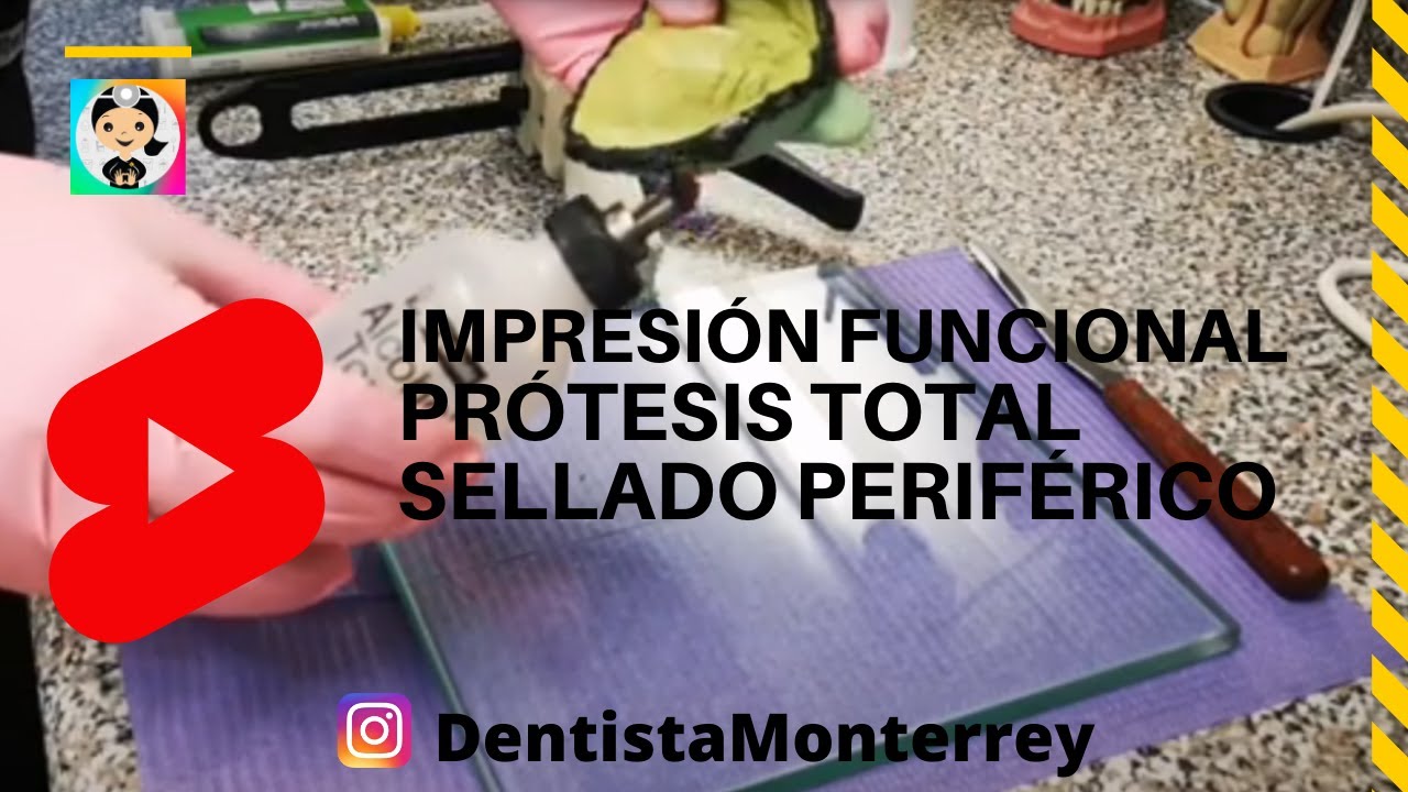 ⏭️ Impresión Dental Funcional SELLADO PERIFÉRICO👅PRÓTESIS TOTAL ...