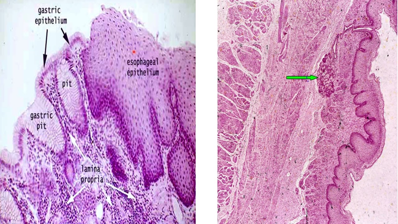 Practical Histology Lab_7 (Digestive system part 2) - YouTube