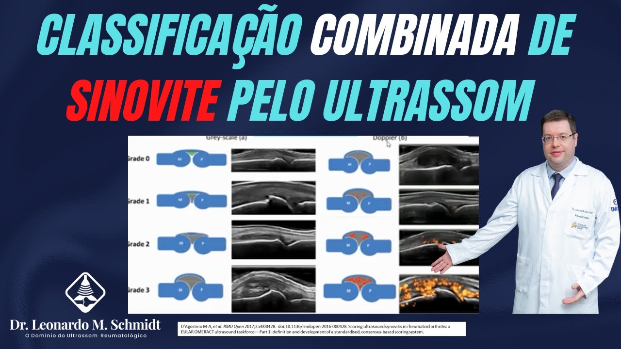 Classificação COMBINADA de SINOVITE pelo ULTRASSOM - YouTube