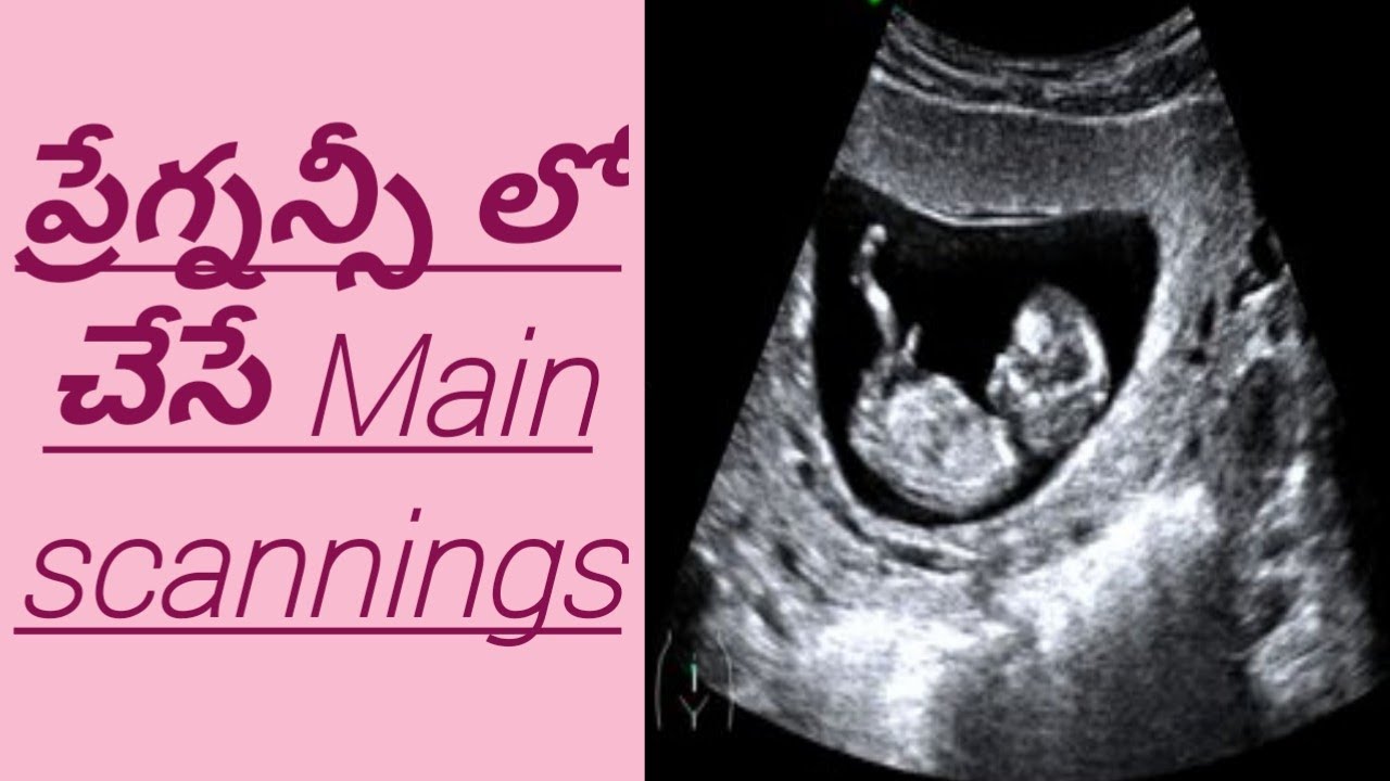 What are the main scannings in pregnancy? - YouTube