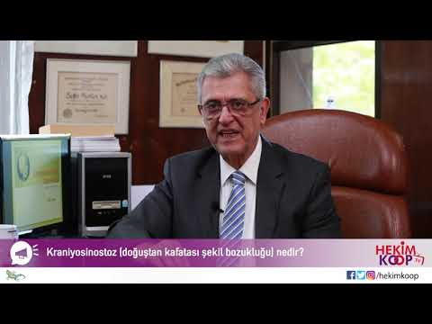 Kraniyosinostoz doğuştan kafatası şekil bozukluğu nedir?