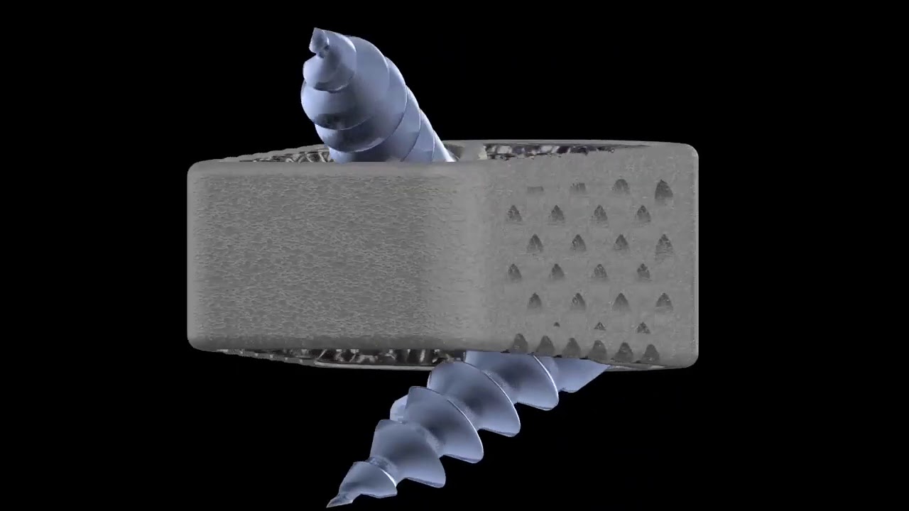 Corelink Surgical: F3D C2 Stand ALONE Cervical - YouTube