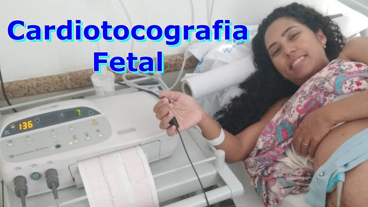 Cardiotocografia Fetal anteparto e intraparto – Tudo que você precisa ...