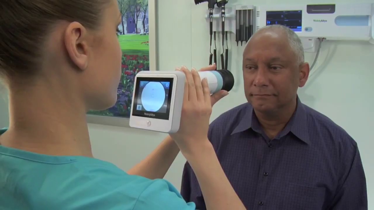 RetinaVue 100 - User Guide - YouTube