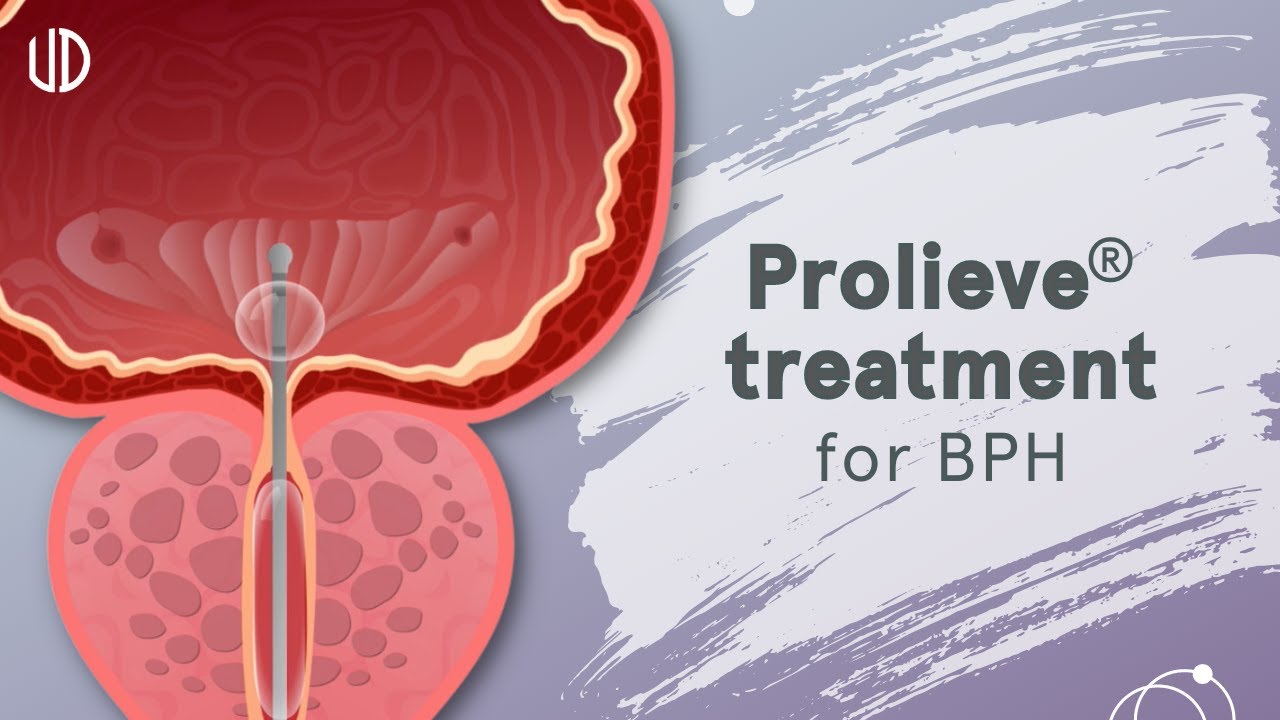 ProlieveⓇ Treatment Explained by Dr Lee Fang Jann - YouTube