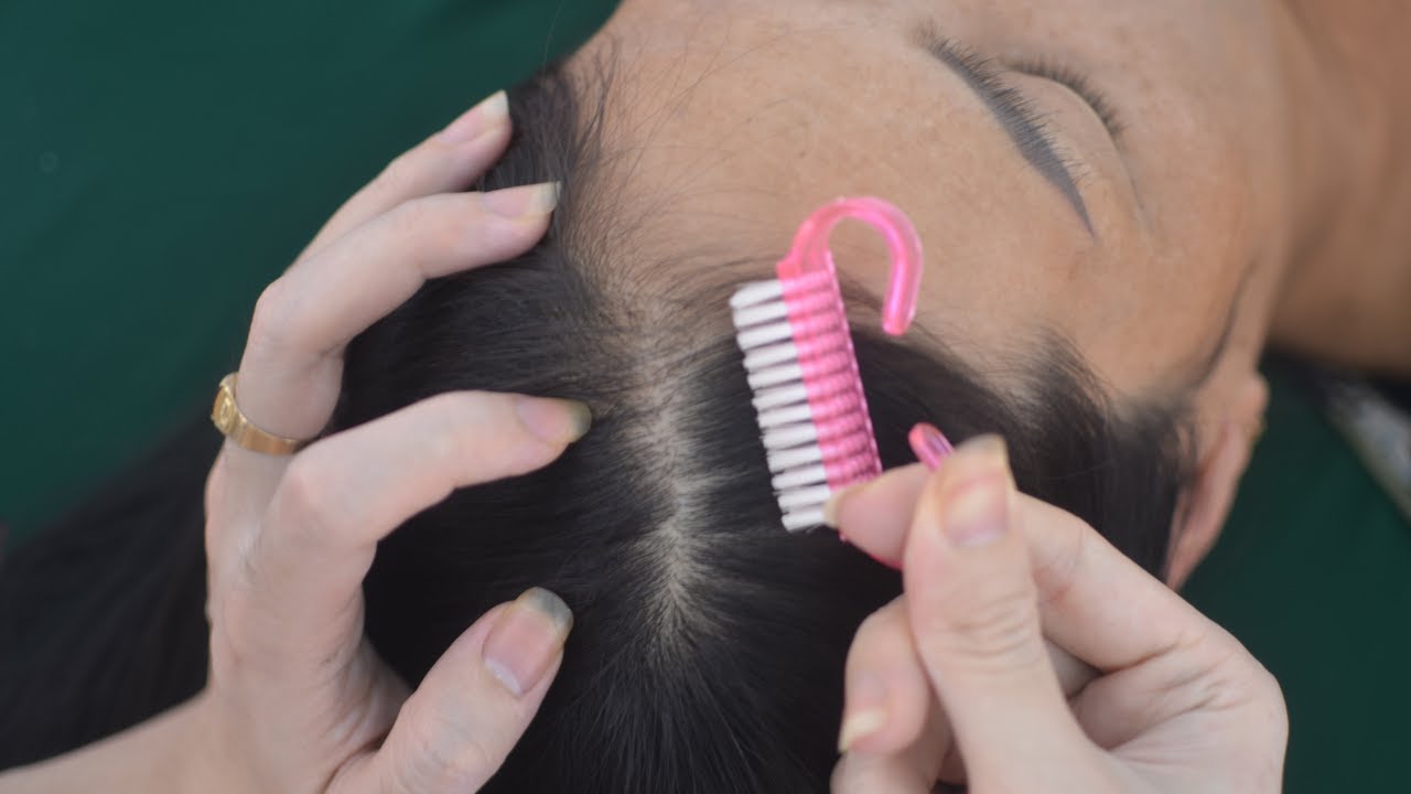 ASMR Aggressive Scalp Scratching Massage, Tingly Hair Sounds With ...