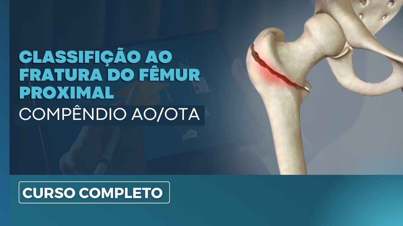 Curso AO de Fraturas do Fêmur Proximal: Como Classificar Corretamente ...