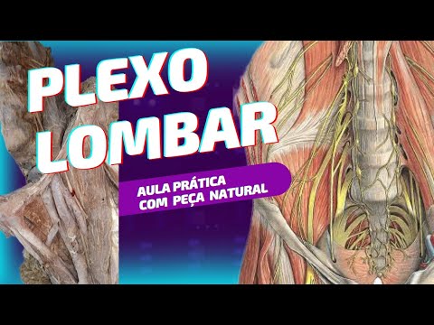 Aula prática de PLEXO LOMBAR!!! - YouTube