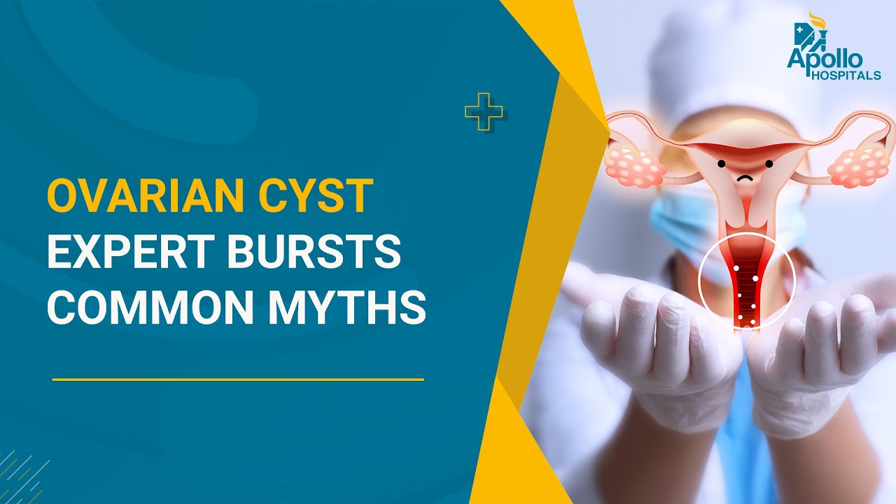 Ovarian Cyst - Expert Busts Common Myths | Infertility | PCOS | Cyst ...
