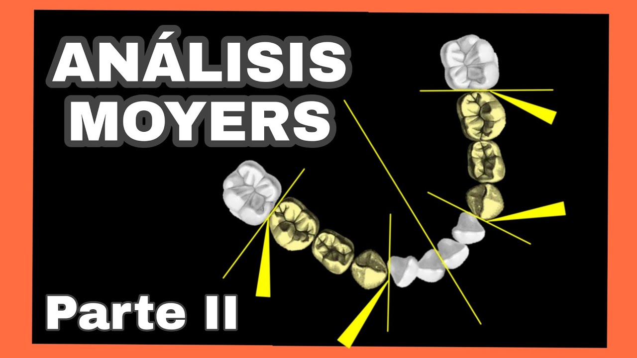 Análisis de Moyers - Parte II - YouTube