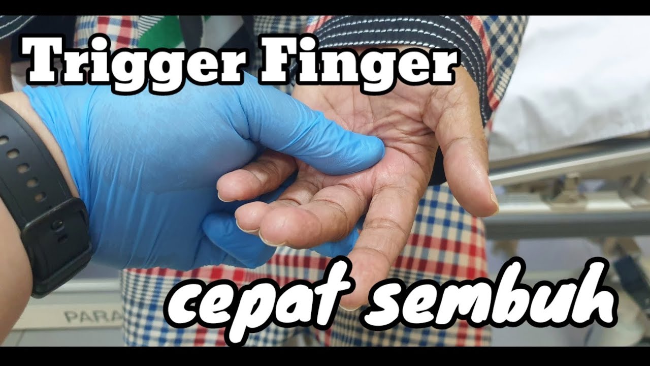 🙌 Trigger Finger Cepat Sembuh Tanpa Operasi - YouTube