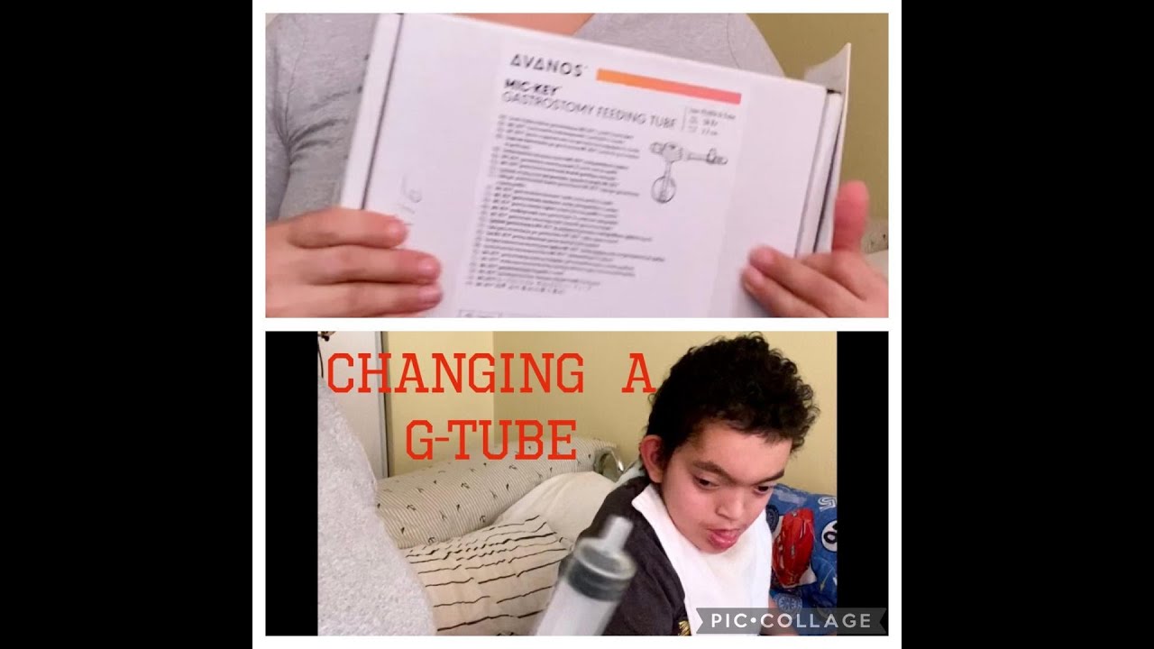 How to change a Gastrostomy Tube ( G-tube ) - YouTube