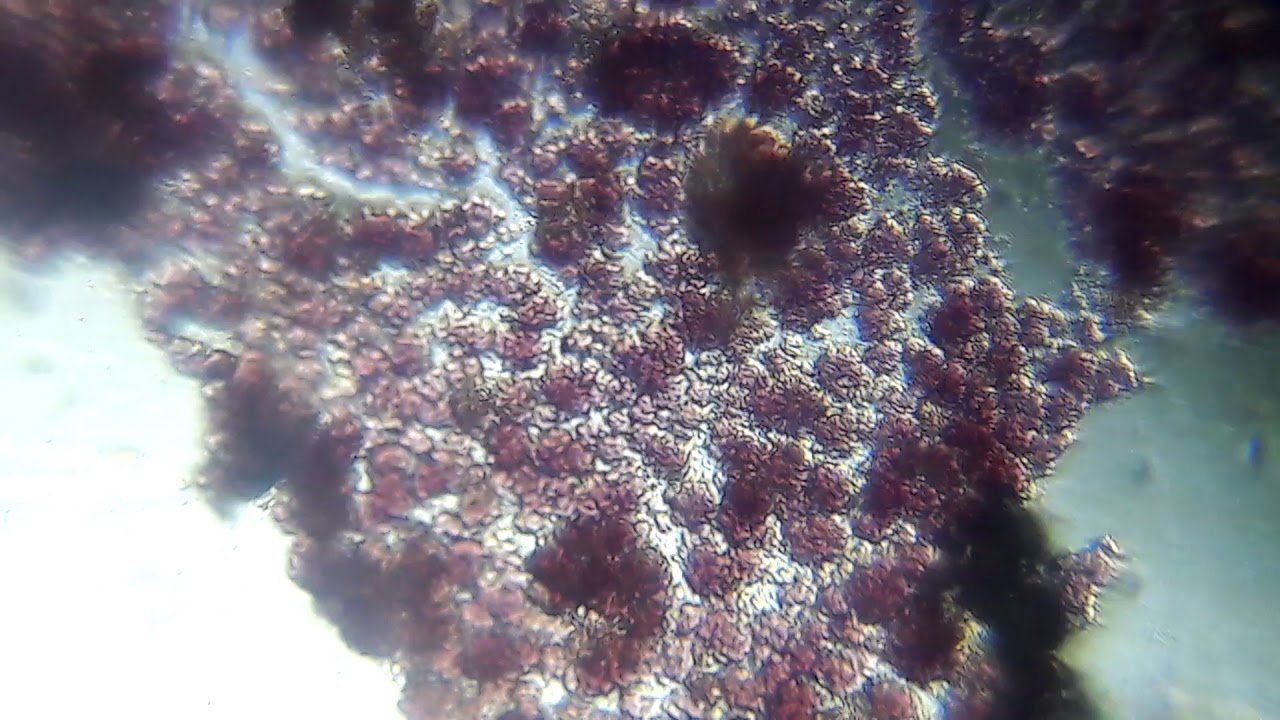 What is this phenomenon? (Bacteria related)? - YouTube