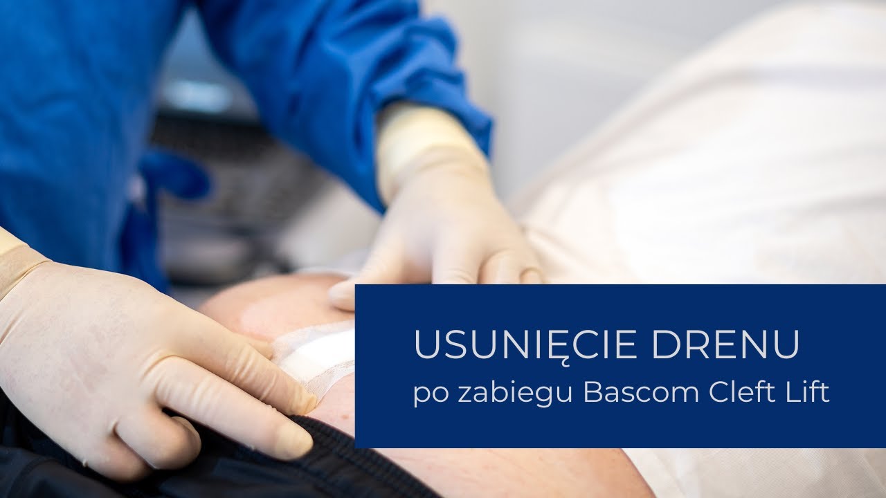 Usunięcie drenu po zabiegu Bascom Cleft Lift - YouTube