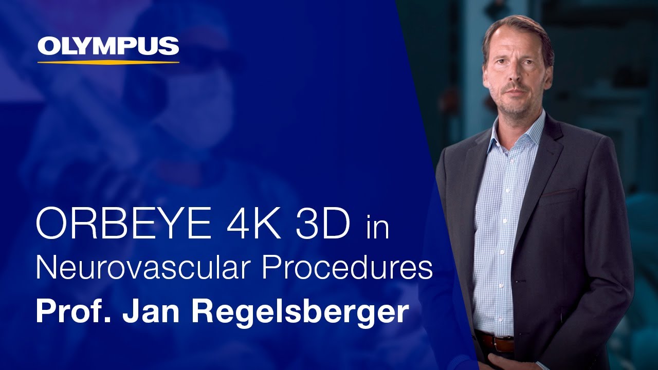 ORBEYE 4K 3D in Neurovascular Procedures - YouTube