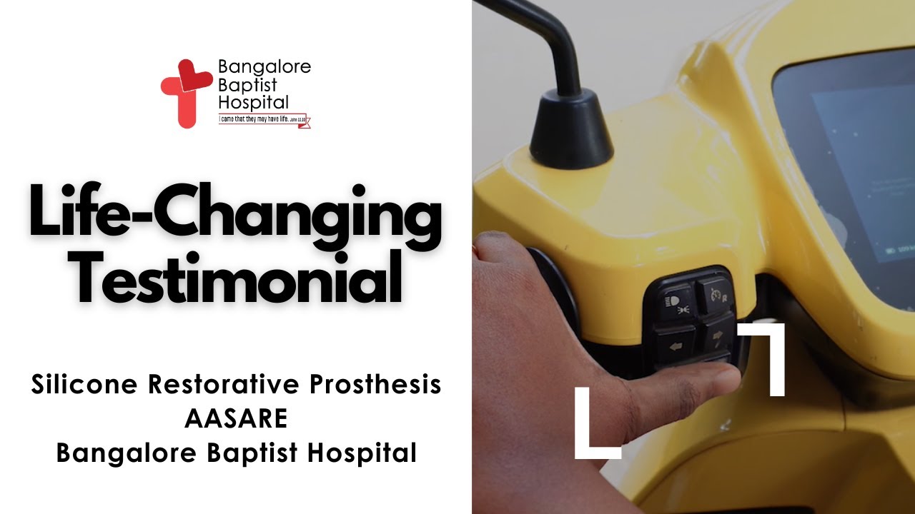 Life-Changing Testimonial: Silicone Restorative Prosthesis @ AASARE ...