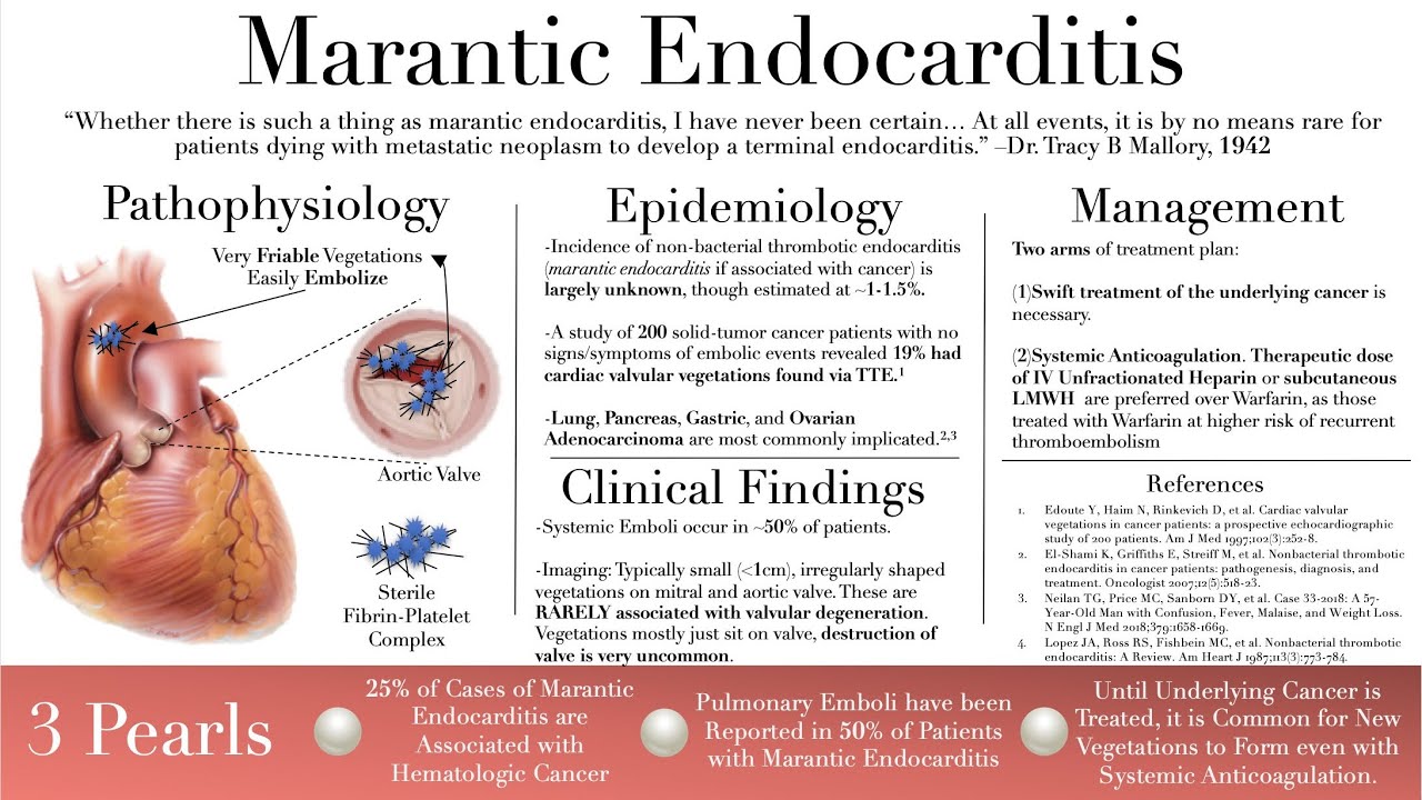 Valvular Lesions in Marantic Endocarditis - YouTube