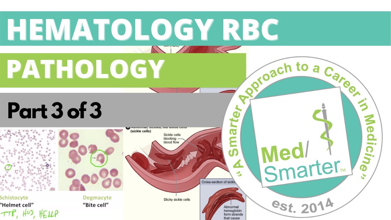 USMLE Step 1 | Hematology RBC Pathology | MedSmarter | Part 3 of 3 ...