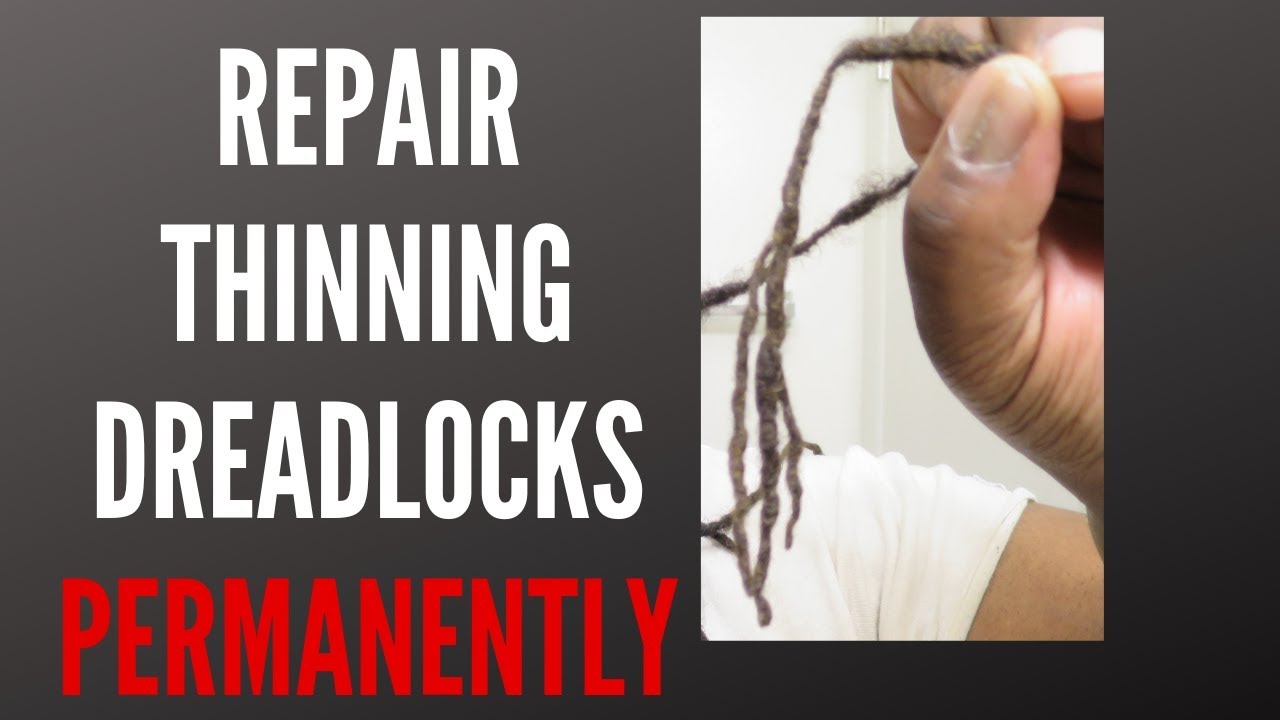 Fix Thinning Dreadlocks FOREVER!! | Hair Grows Away From Locs # ...