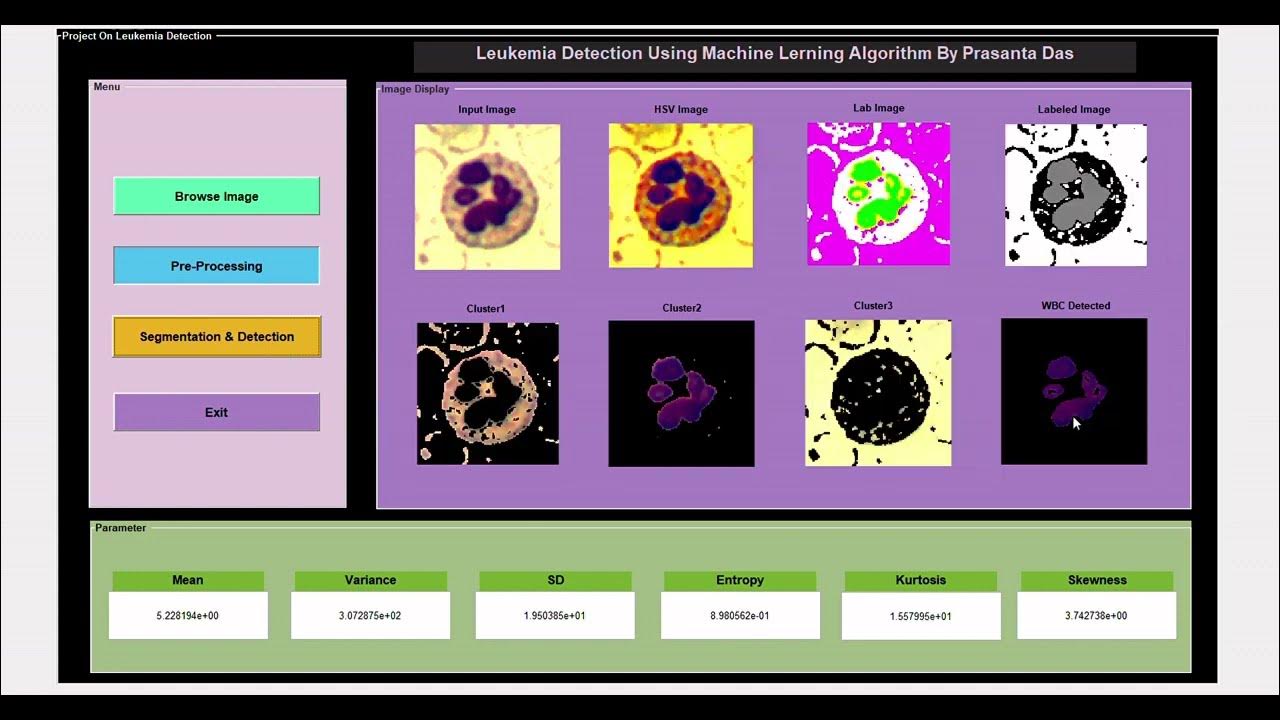 Automated Cancer (Leukemia) Detection Using Machine Learning - YouTube