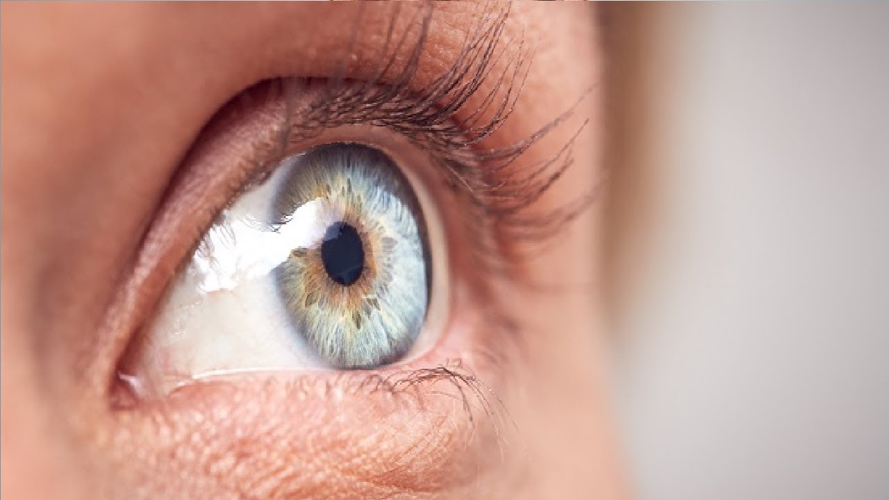 how does pink eye start - YouTube